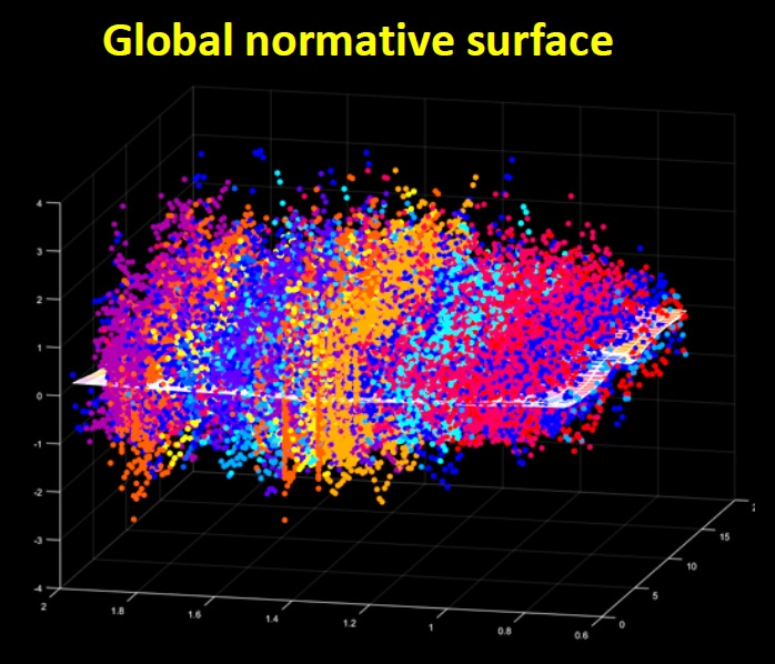 Global Brain Consortium Project: Global EEG Norms